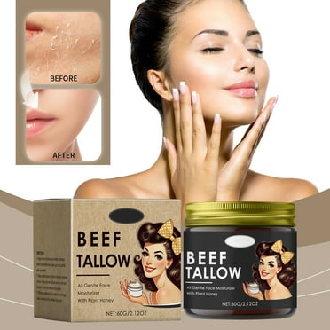 Meadow Bliss Beef Tallow SAF21 for Skin - Moisturizer Grass Fed ...