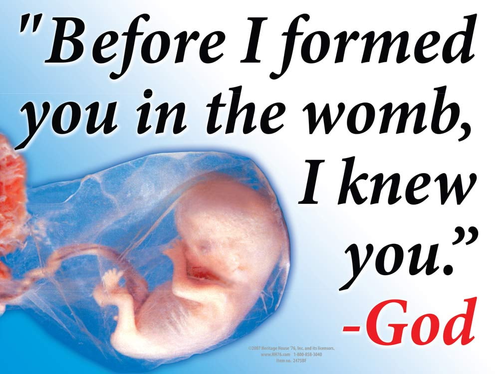 Before I Formed You Pro-Life Yard Sign - Walmart.com