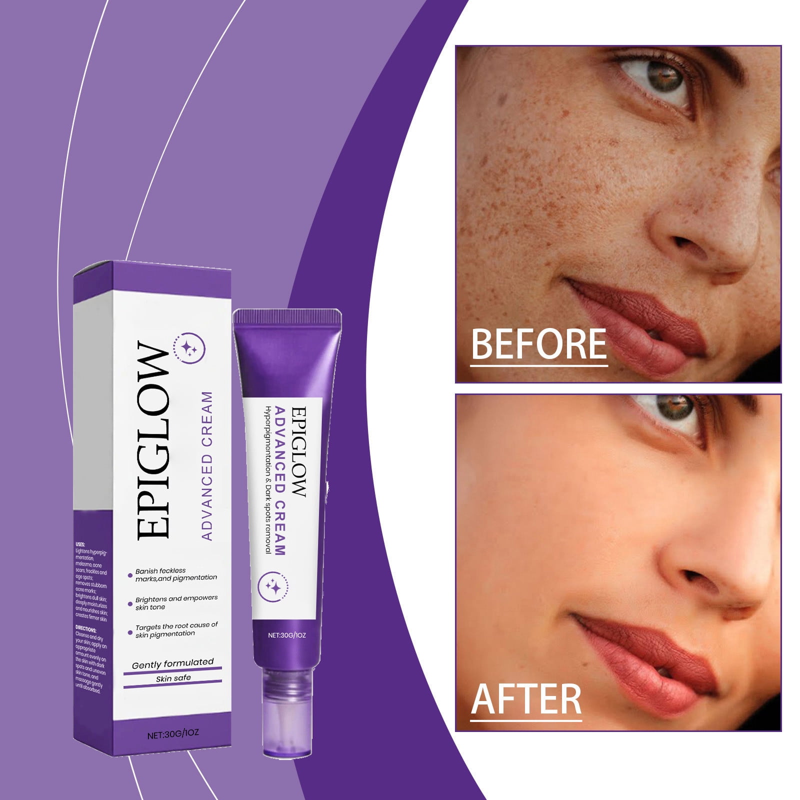 Bestselling, Brightening Cream 30g, Removing and Brightening Cream ...