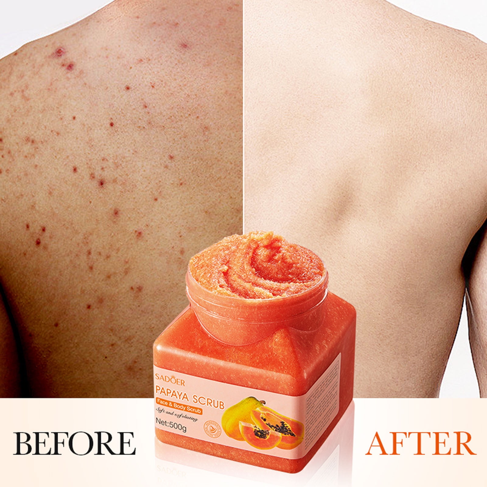 Betivan Papaya Essence Brightening Exfoliating Peeling Gel, Papaya ...