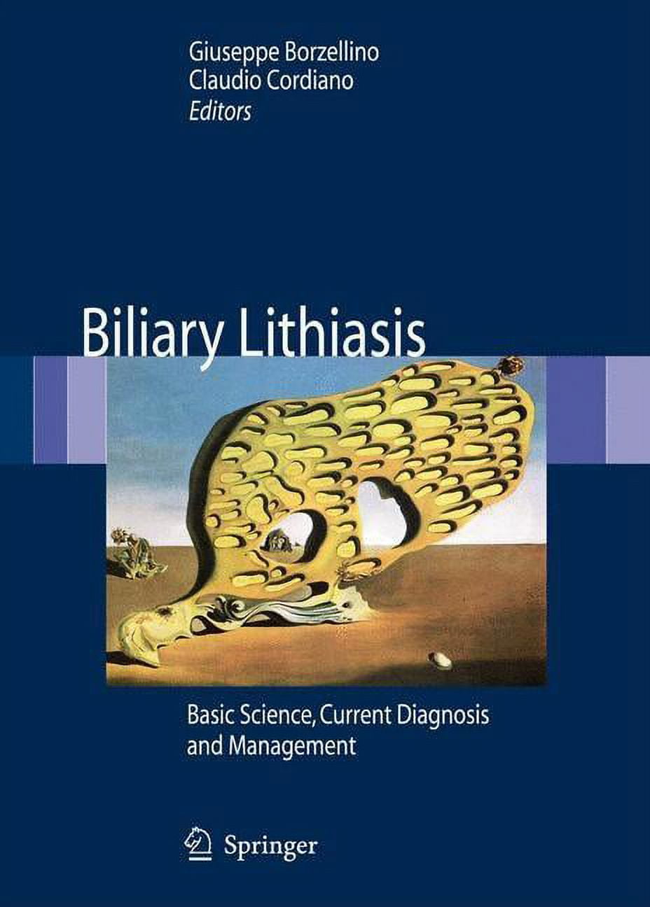 Biliary Lithiasis: Basic Science, Current Diagnosis and Management ...