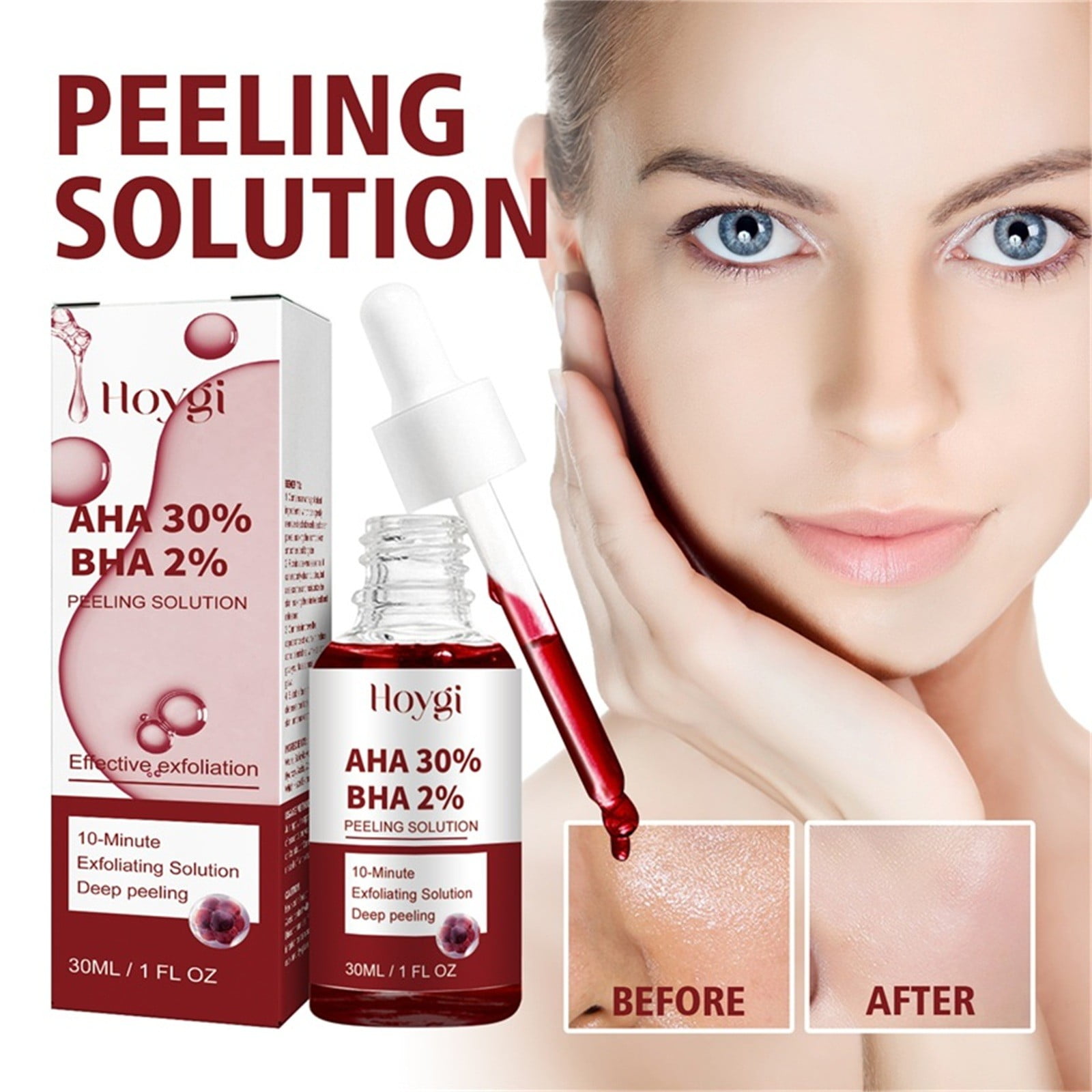 Bilqis Peeling Solutions, Glycolic Peel With Lactic Aloe Vera, Facial ...
