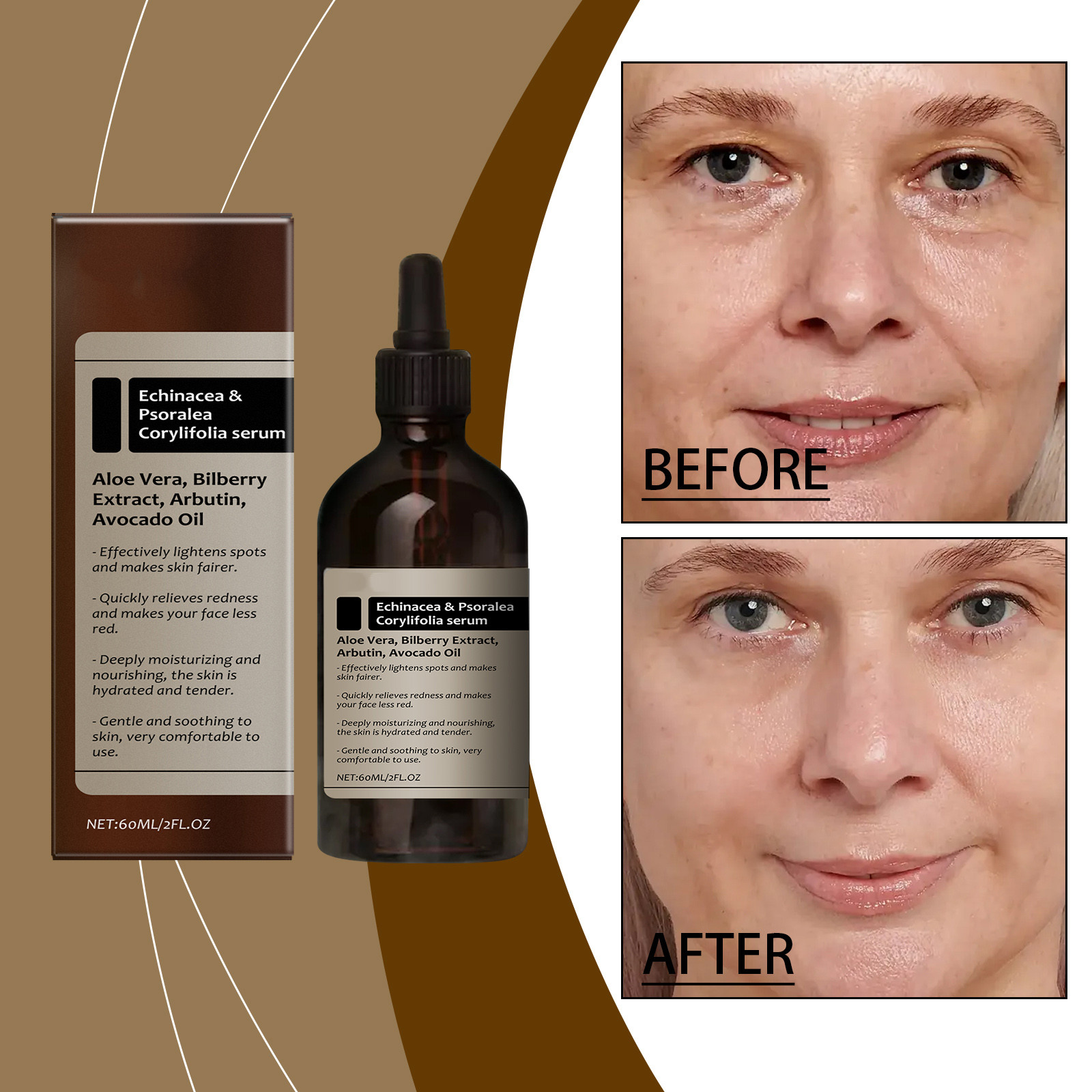 Binmer Antioxidant Spots-Removing Serum Calm And Balances Relieves Skin ...