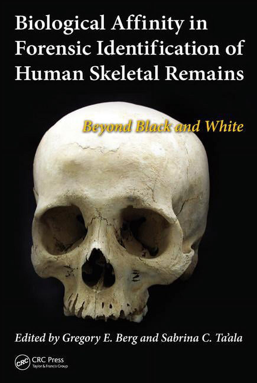 Biological Affinity in Forensic Identification of Human Skeletal ...