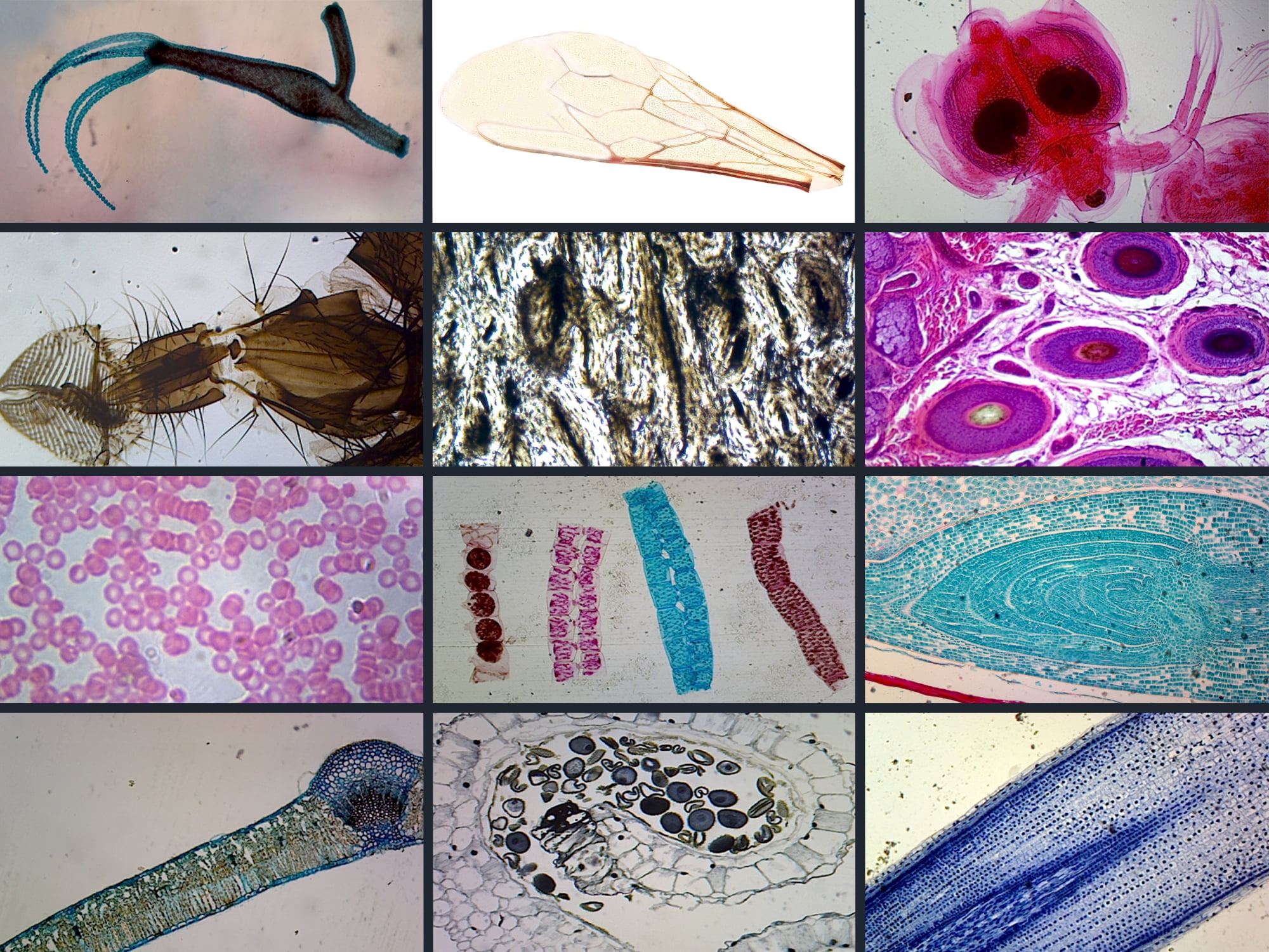Biology Microscope Slide Set – 23 Slides - Walmart.com