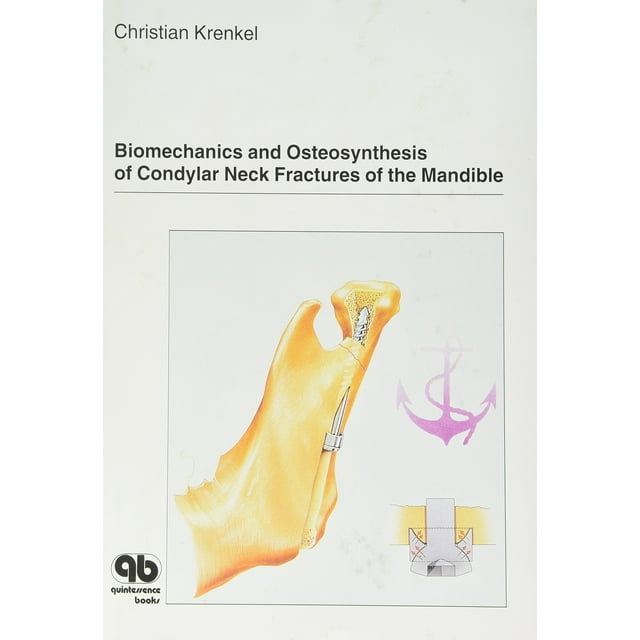 Biomechanics and Osteosynthesis of Condylar Neck Fractures of the ...
