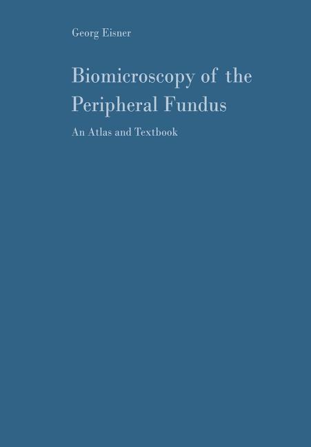 Biomicroscopy of the Peripheral Fundus: An Atlas and Textbook - Walmart.com