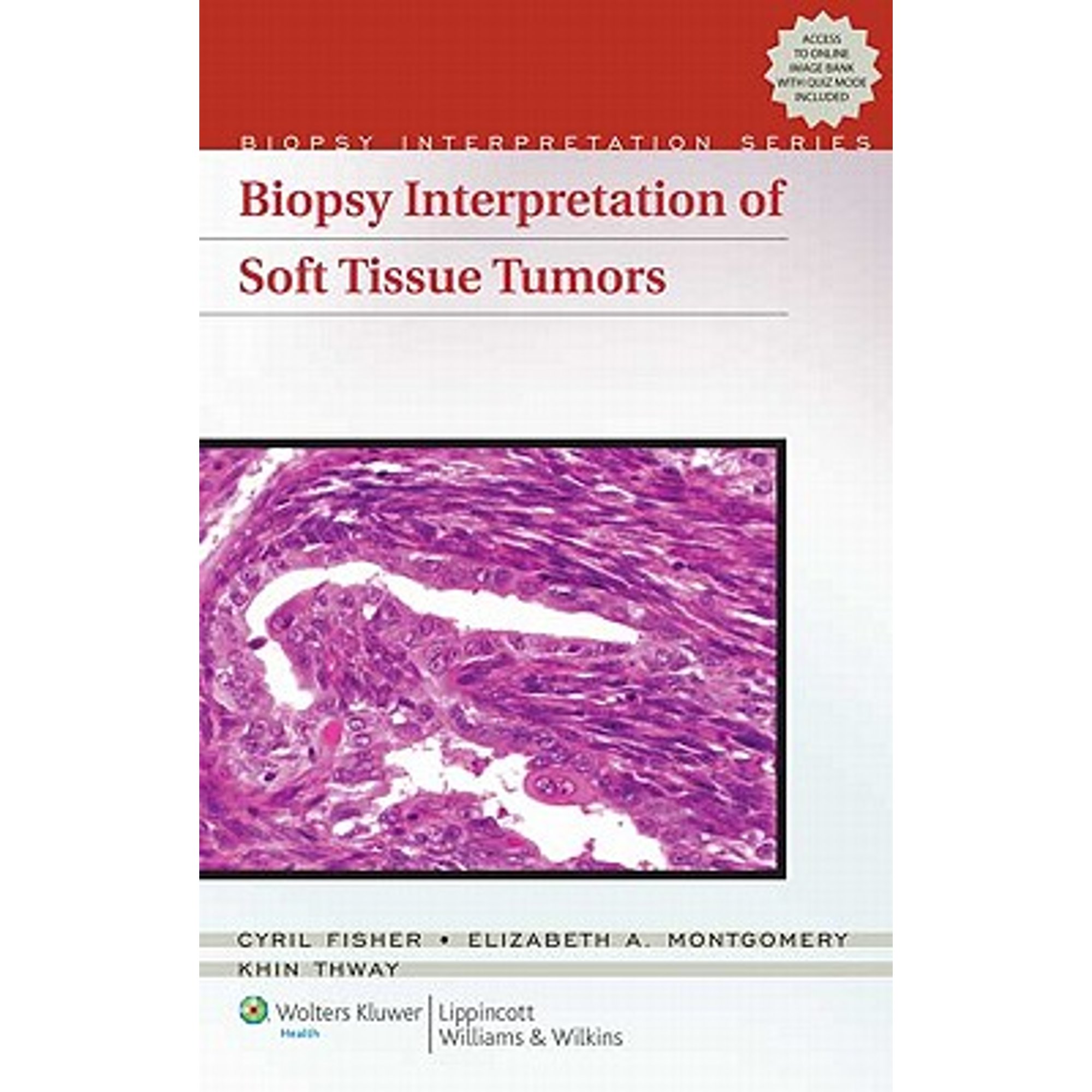 Soft Tissue Biopsy