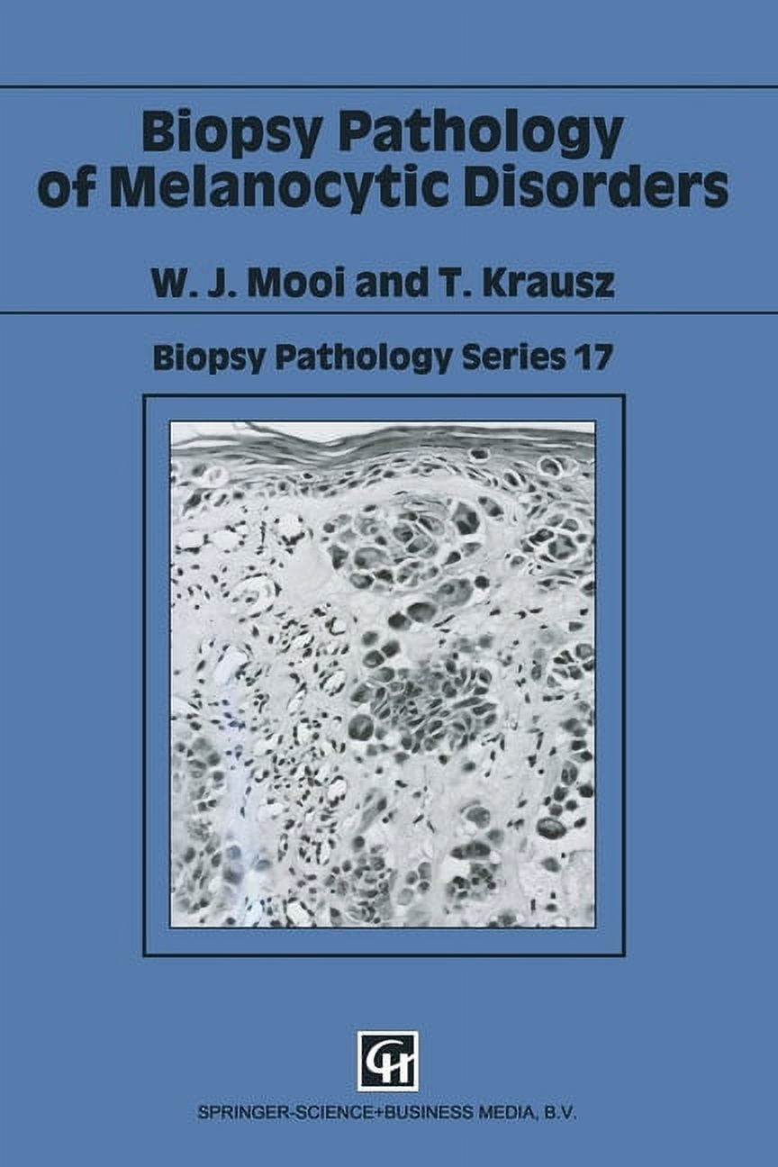 Biopsy Pathology Biopsy Pathology of Melanocytic Disorders, Book 17 ...