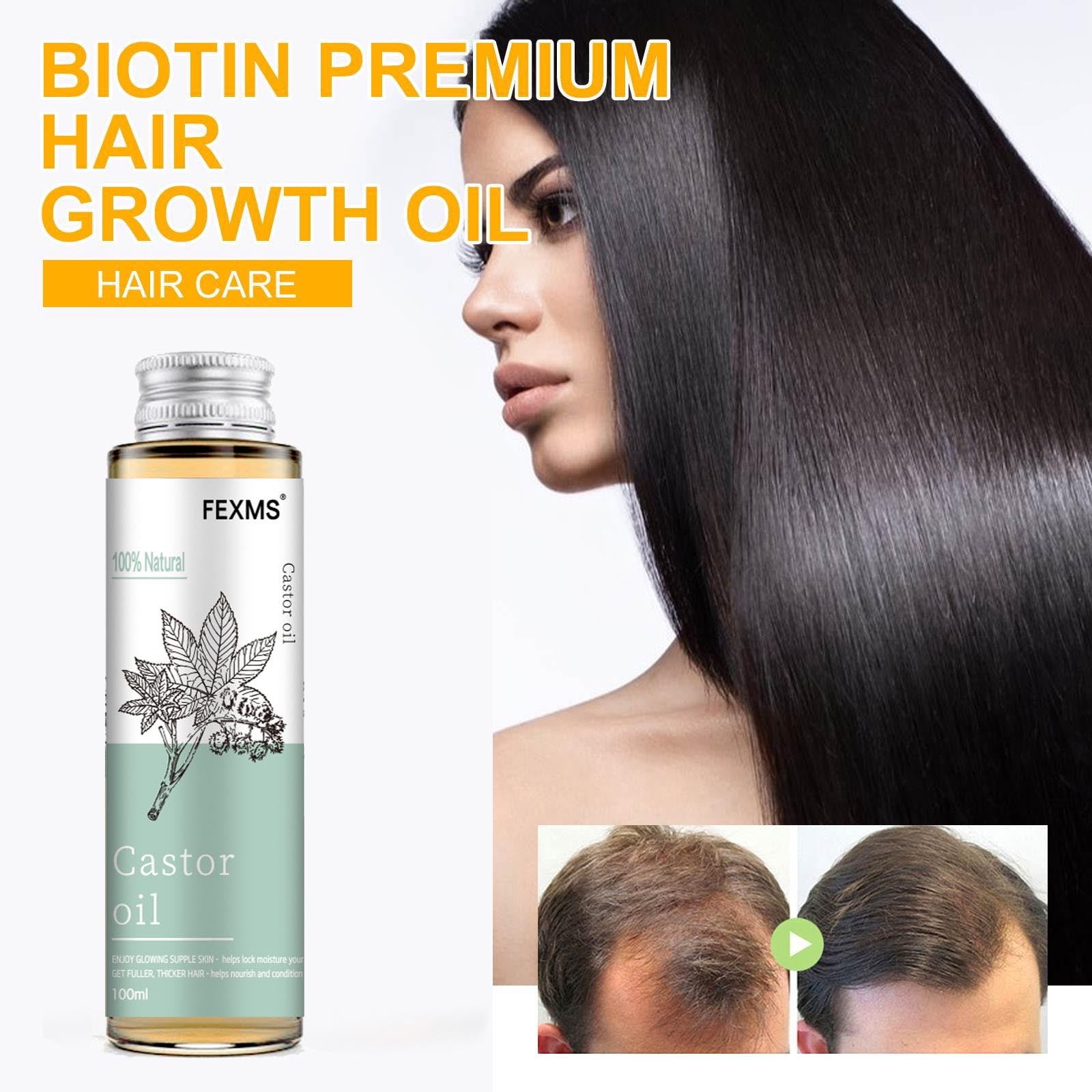 Biotin Fast-growing Hair Oil, Antihair Loss Serum, 00ml, Natural Hair ...
