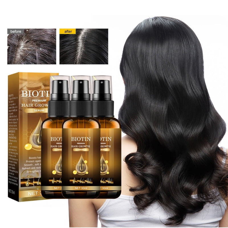 Biotin Hair Growth Spray, Castor Oil Treatment Serum Anti Hair Loss for ...