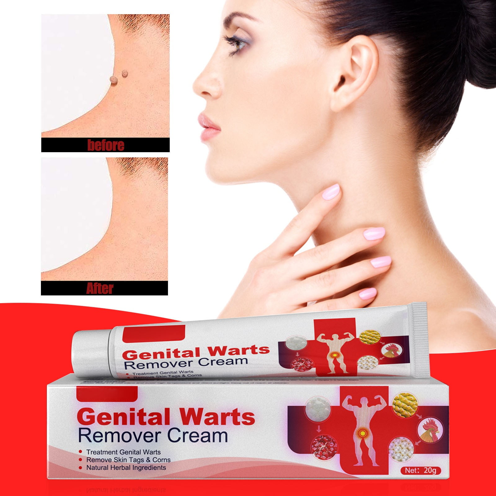 Birthday Gifts Wartreducing Ointment For Skin Calming Warts Hands Feet ...