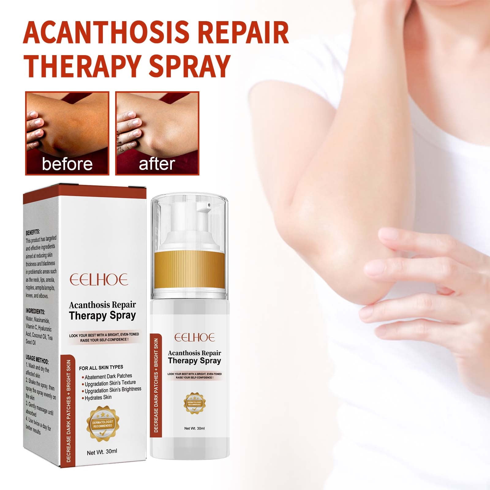 Black Acanthosis Repair Spray To Improve Skin Spray,Fade Black Spots ...