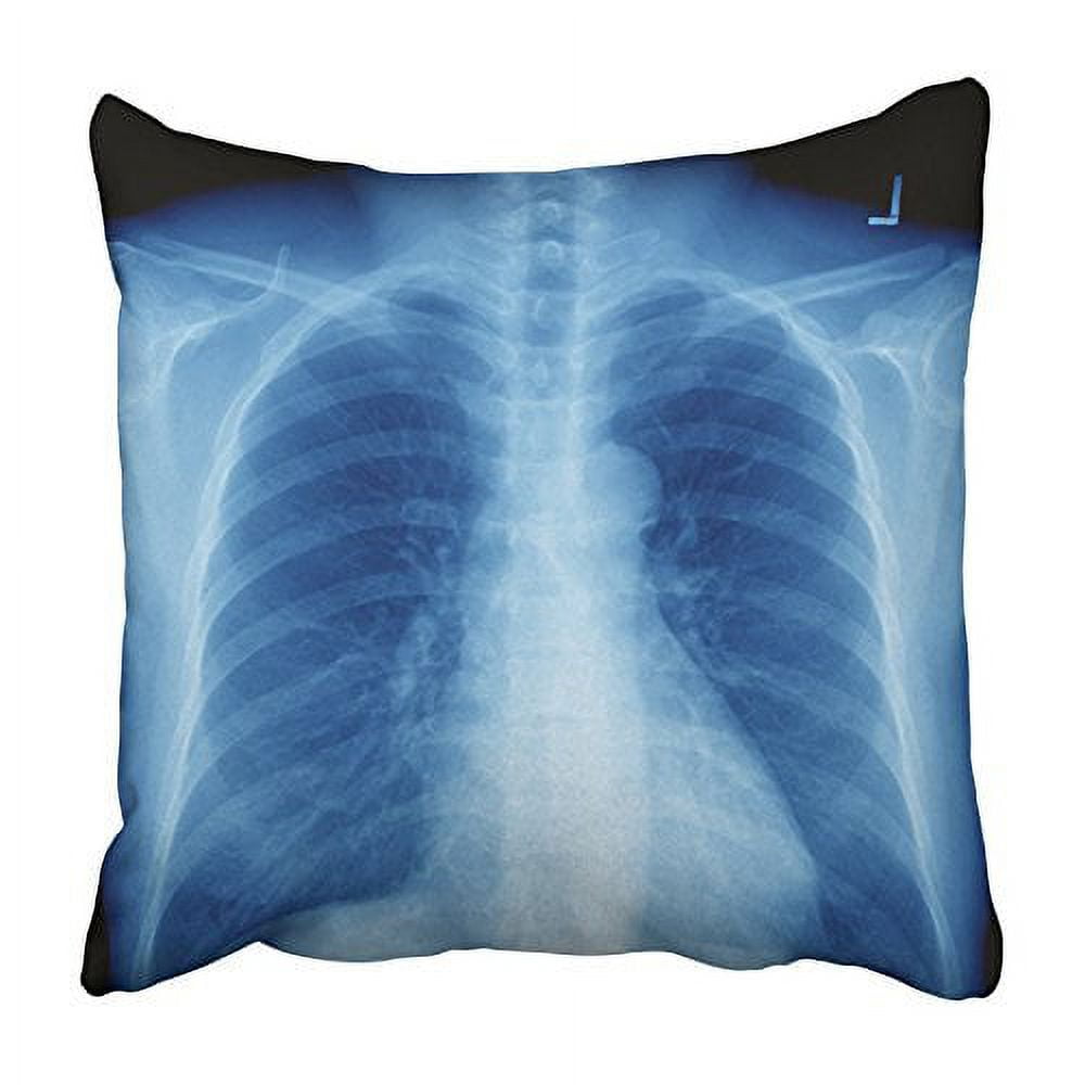 X Ray Covers