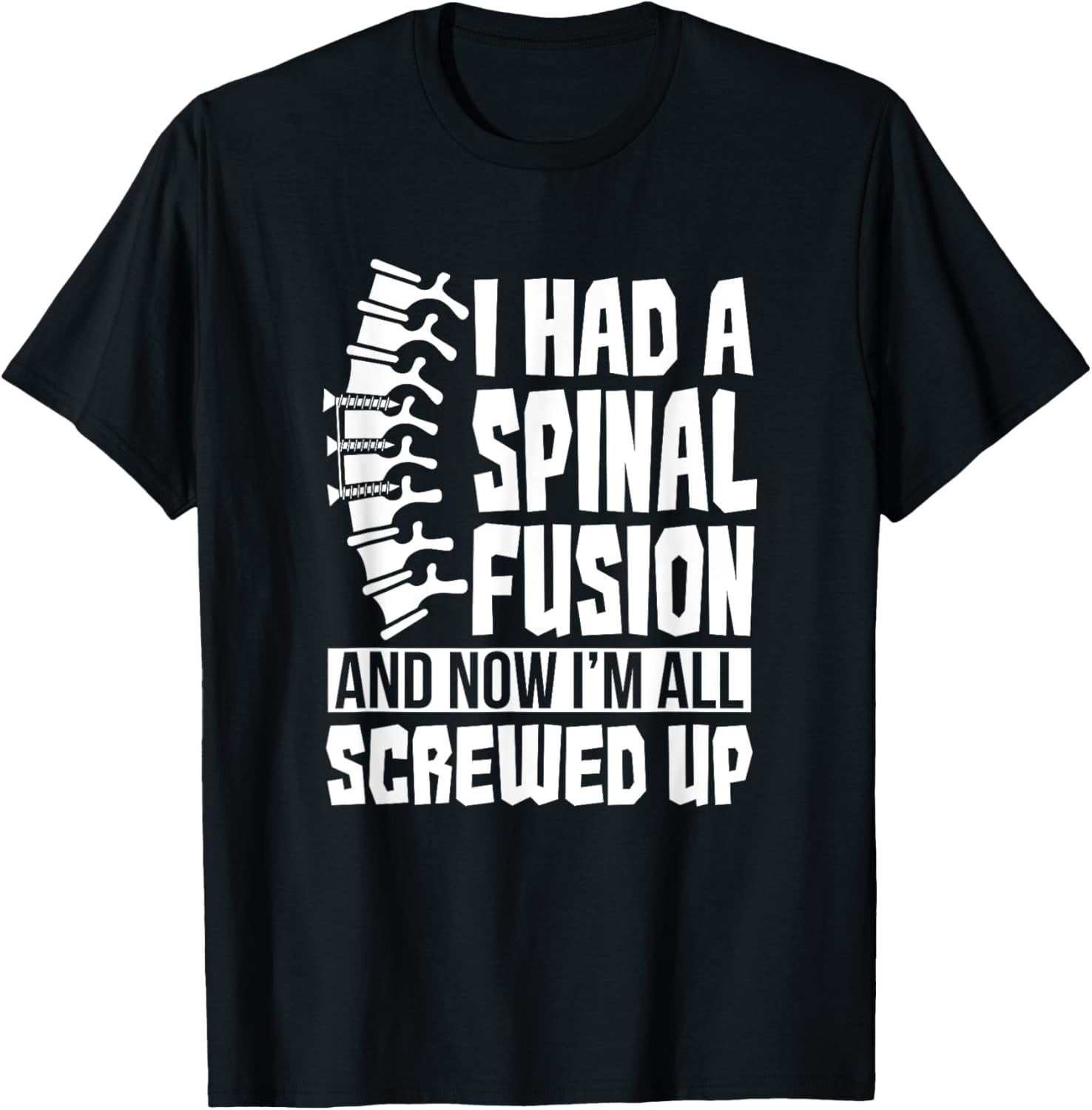 Black for both men and women Spinal Fusion All Screwed Up - Spine ...