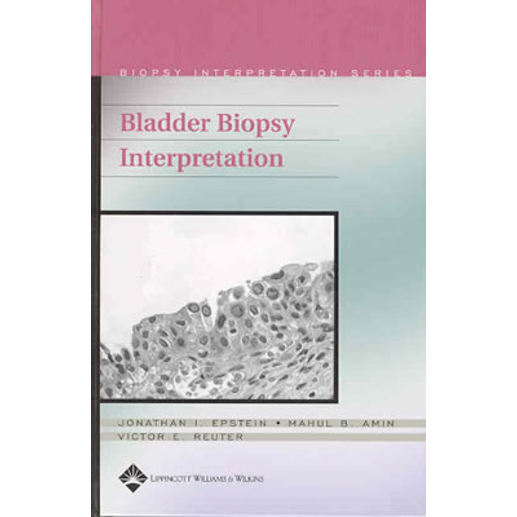 Pre-Owned Bladder Biopsy Interpretation (Hardcover) 9780781742764 ...