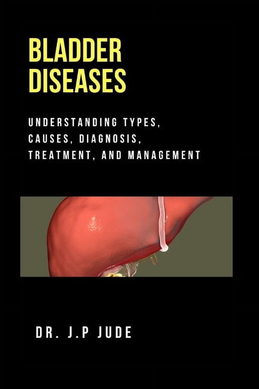 Bladder Diseases: Understanding Types, Causes, Diagnosis, Treatment ...