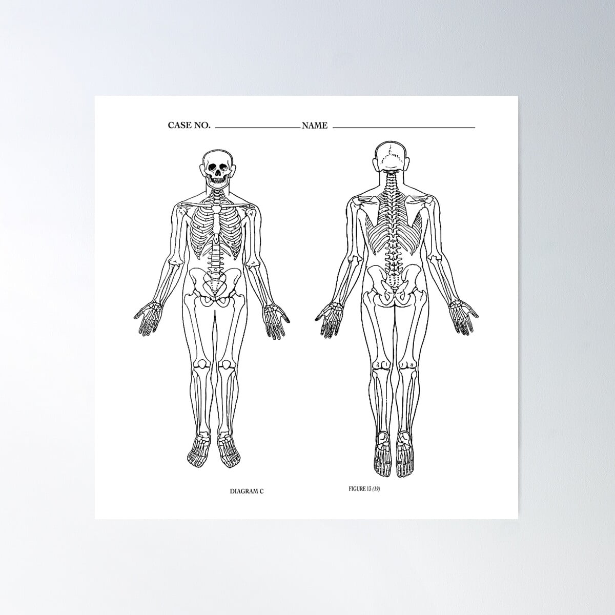 Blank Autopsy Diagram, Skeleton, Anterior And Posterior Poster Wall Art ...