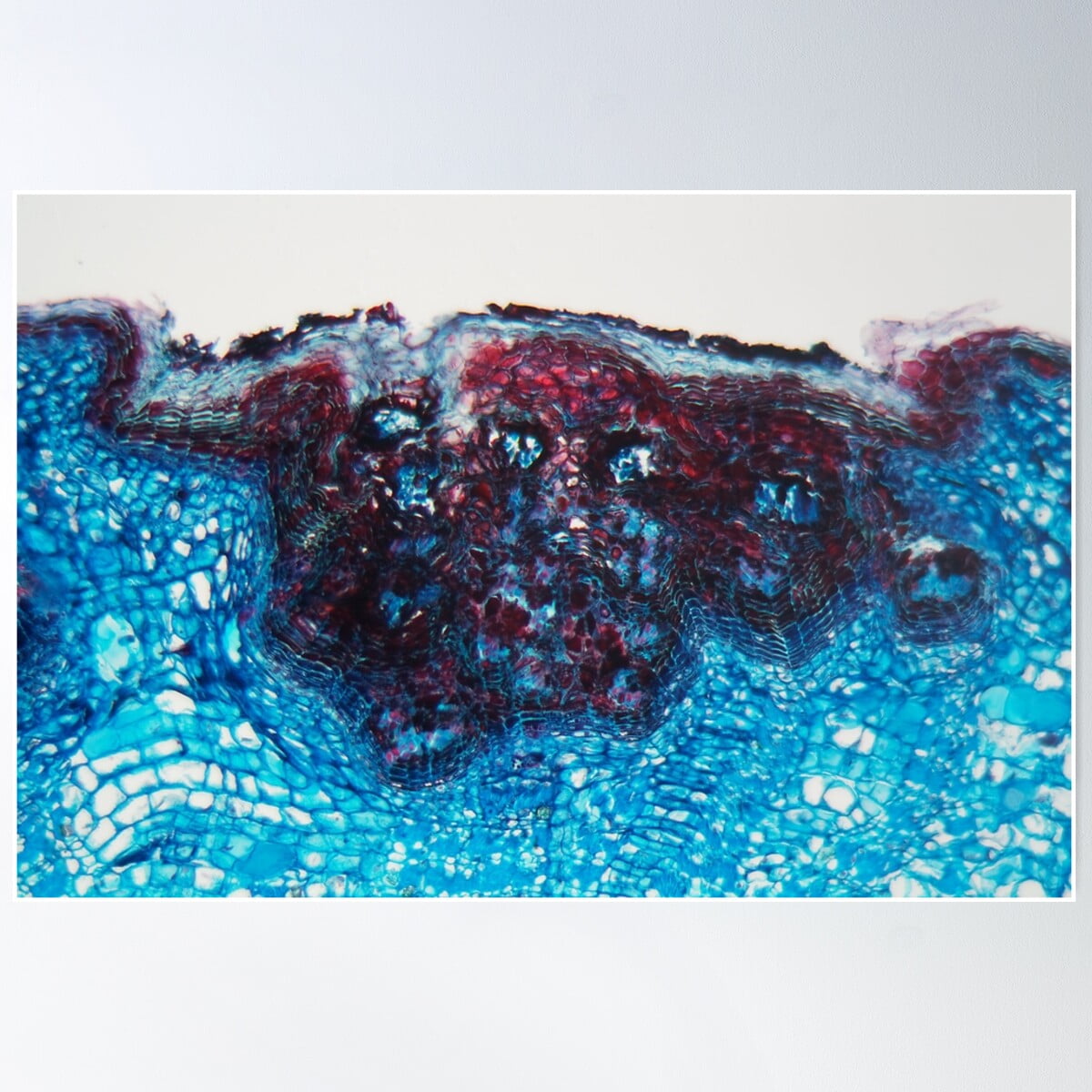 Blue Colored Cells Of A Plant Stem With A Disease Under A Microscope ...