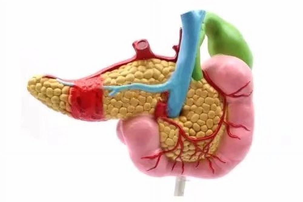 BoNew Human Duodenum Gall Bladder Disease Anatomy Medical Model Life ...