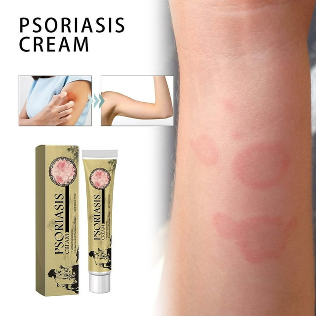 Body Lotion 20 G For Adults And Against Rose Rash White Rash Itchy Skin Red Rash