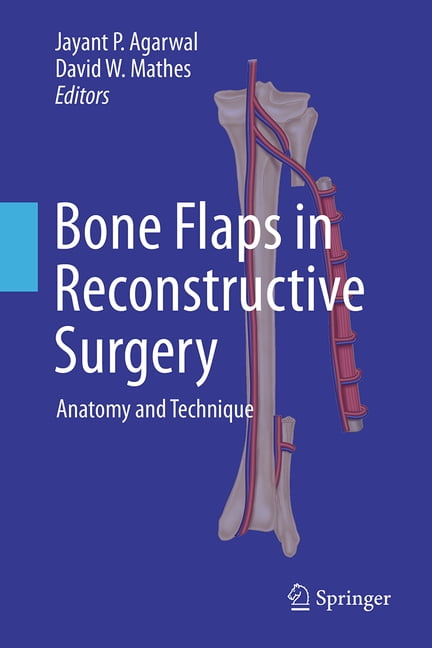 Bone Flaps in Reconstructive Surgery: Anatomy and Technique, (Hardcover ...
