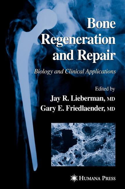 Bone Regeneration and Repair: Biology and Clinical Applications ...