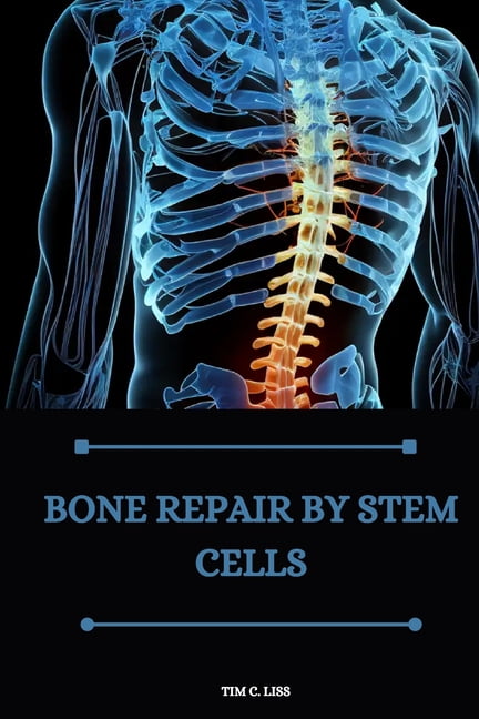 Bone repair by stem cells (Paperback) - Walmart.com
