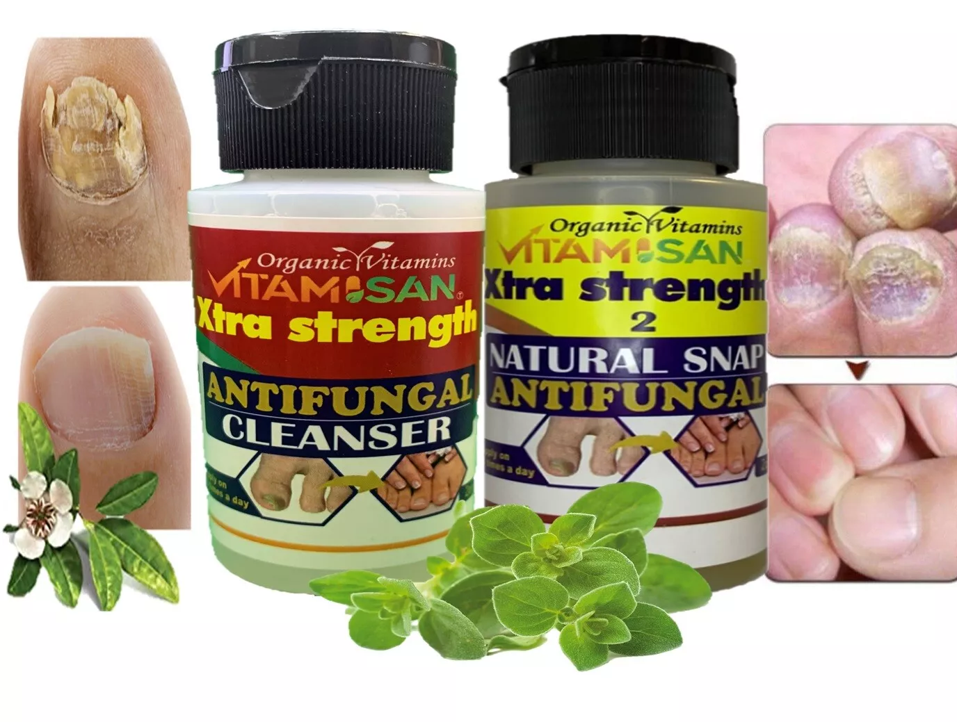 Bonzelo Anti Fungal Wild Oregano Oil Toenail Fungus Athletes Foot Nail Support Fungi Catalogs