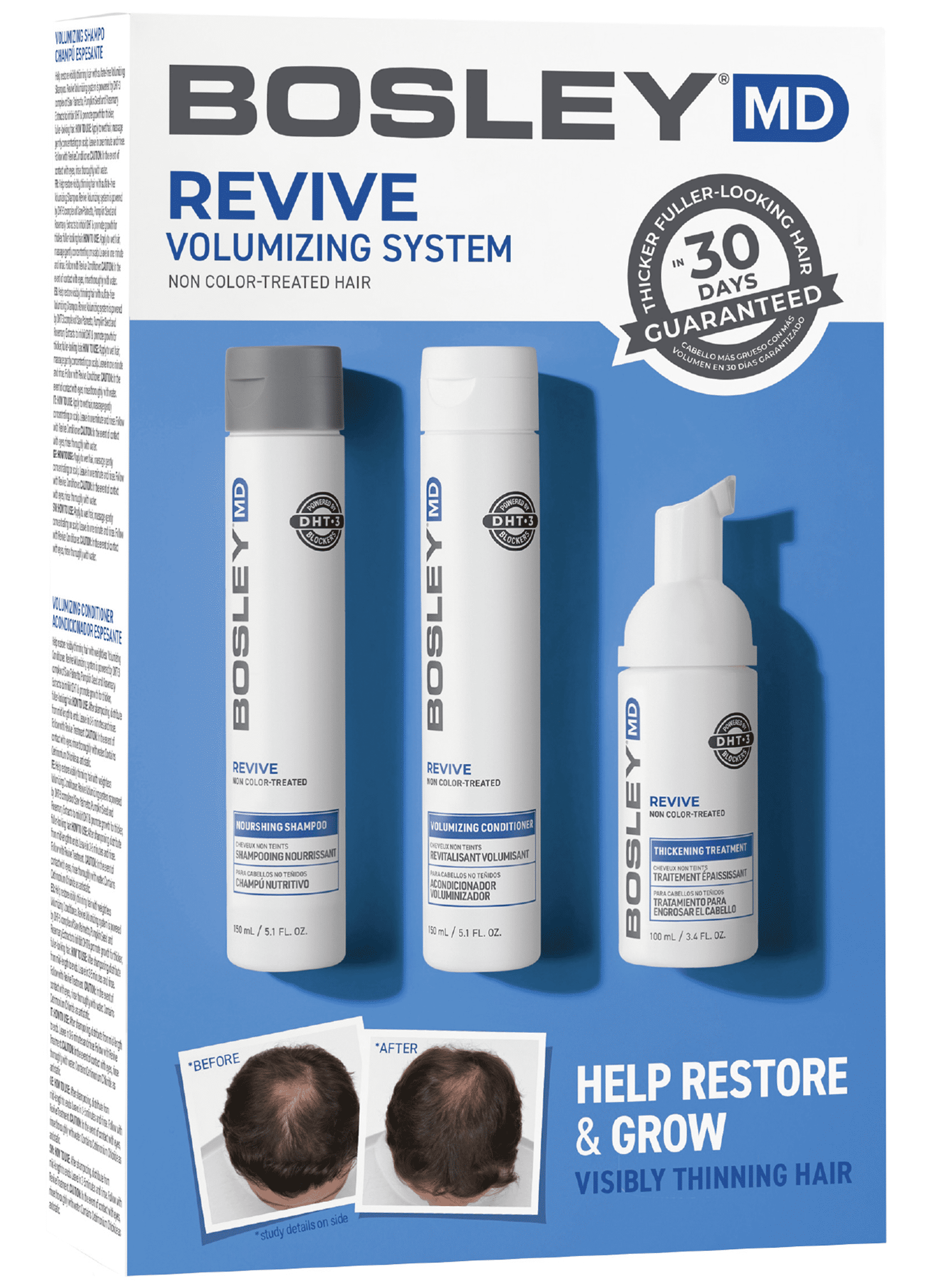 Bosley MD 30 Day Revive Starter Kit for Thinning, Non Color-Treated ...
