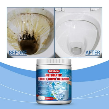 EUDIDV Toilet Bowl Cleaners Toilet Bowl Cleaner 100ml Toilet Cleaner ...