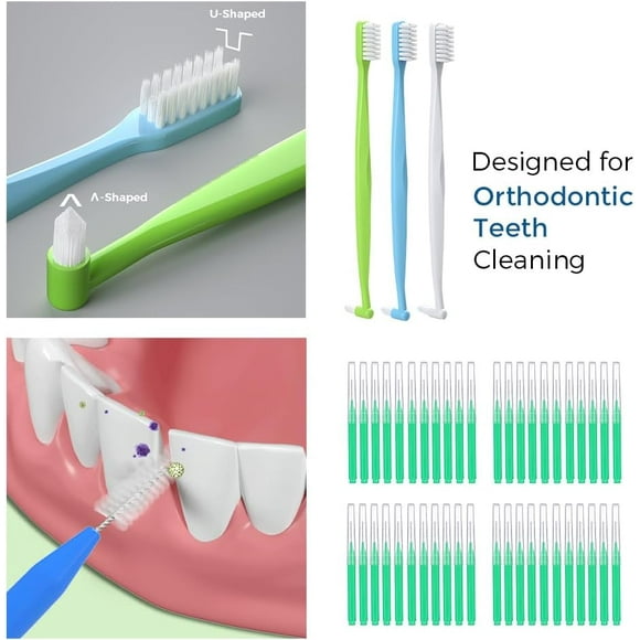 Orthodontic Wax Braces