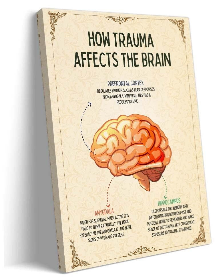 Brain Anatomy Wall Art Prints How Trauma Affect Brain Poster Mental ...