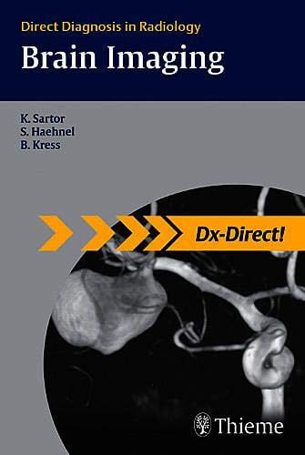 Brain Imaging: Direct Diagnosis in Radiology - Kress, Bodo - Walmart.com