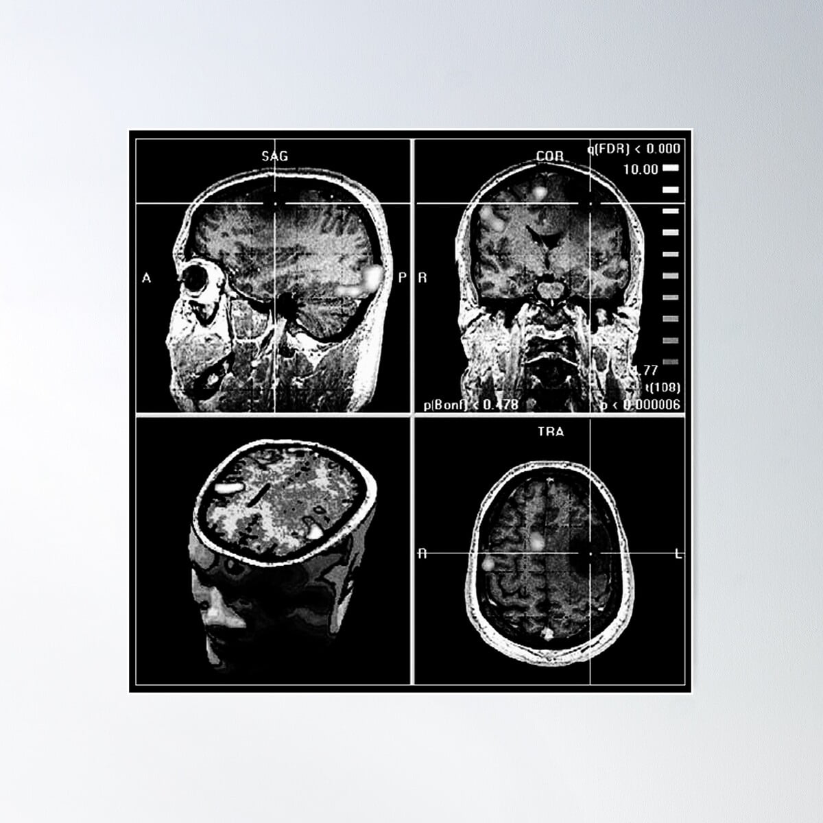 Brain Scan Poster Wall Art, Modern Wall Decor For Living Room Bedroom ...