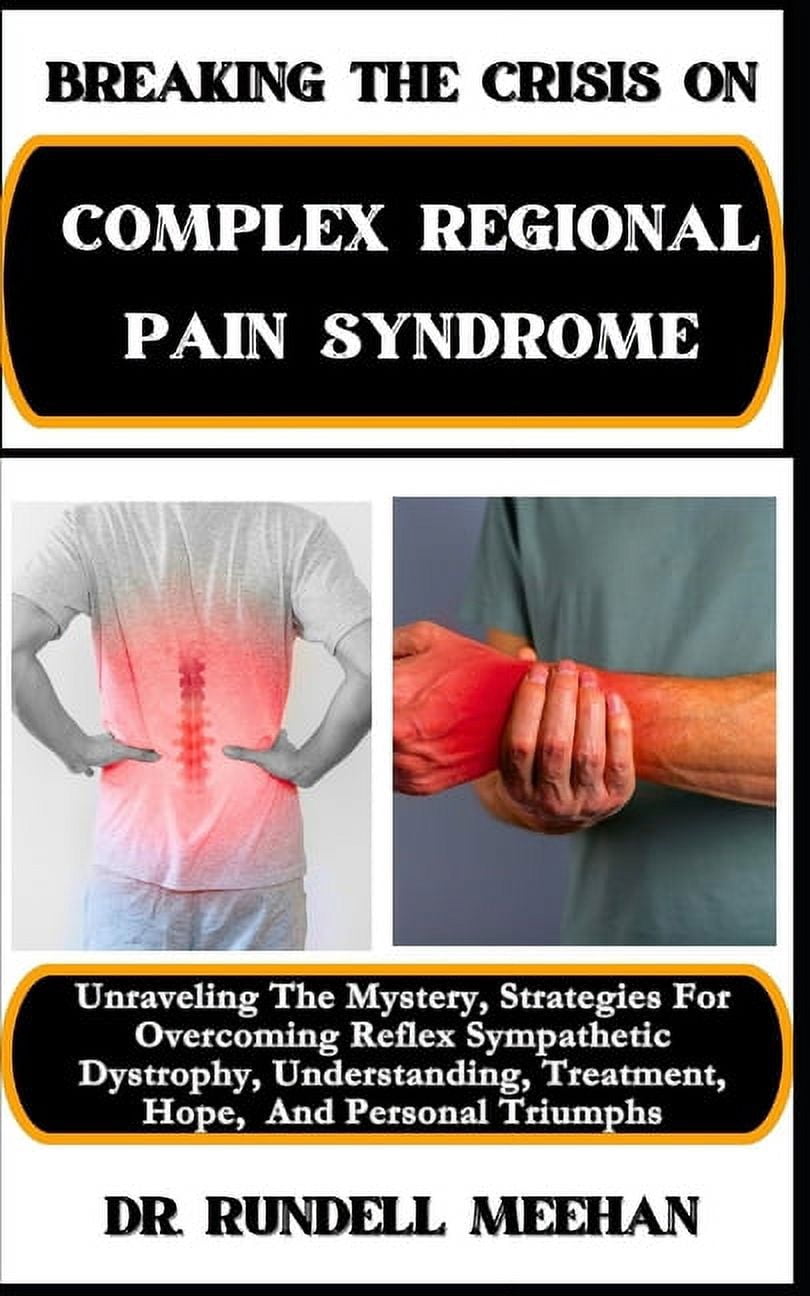 Breaking the Crisis on Complex Regional Pain Syndrome: Unraveling The ...