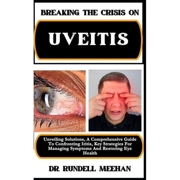 Breaking the Crisis on Uveitis: Unveiling Solutions, A Comprehensive ...