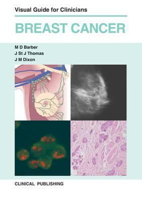 Pre-Owned Breast Cancer: Visual Guide for Clinicians (Hardcover ...