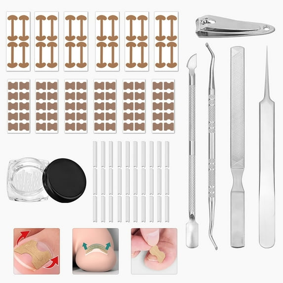 Breathable Ingrown Toenail Correction Set, Includes Strips Patches File ...
