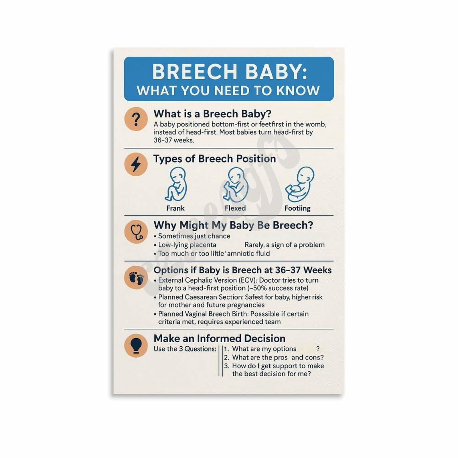 Breech Baby Guide Poster Childbirth Education Wall Art Clinic Decor ...