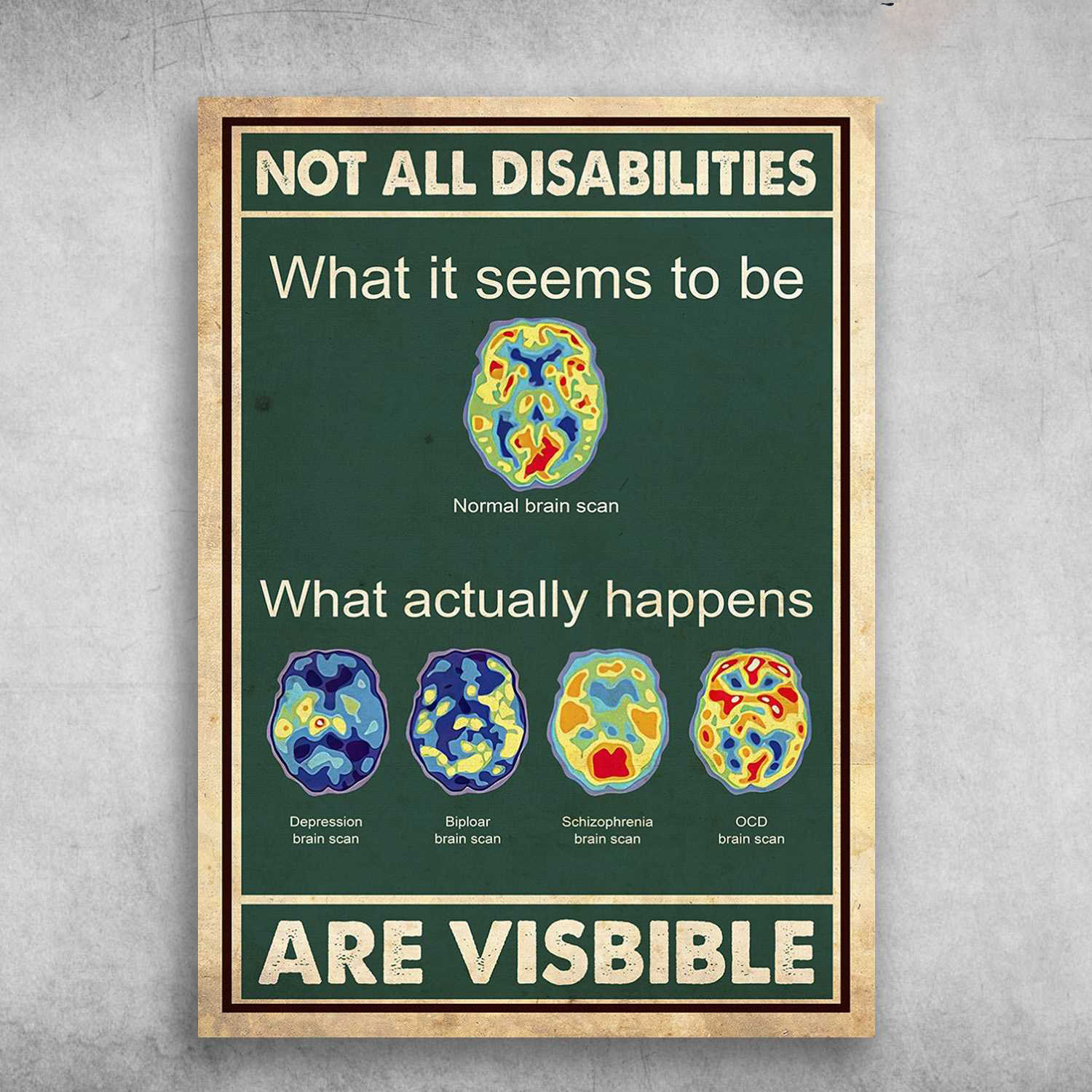 Brian Scan - Not All Disabilities, What It Seems To Be Normal Brain ...