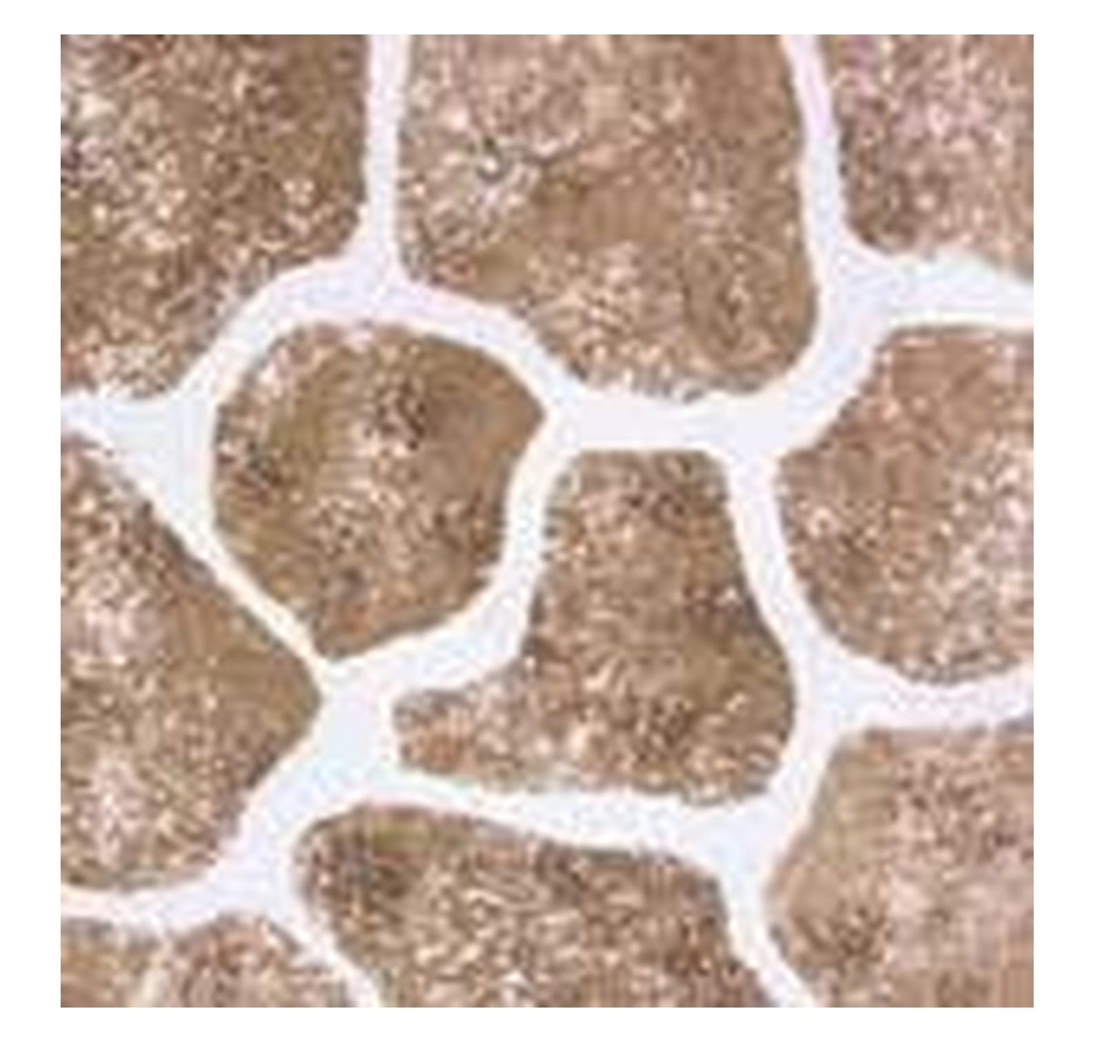 Brick or Stone Patio and Wall Stencils | DIY Home Decor Stencils ...