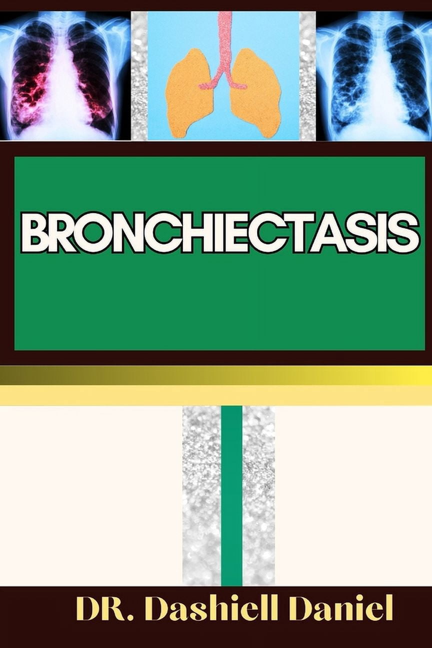 Bronchiectasis: Expert Guide to bronchiectasis Causes, Symptoms ...