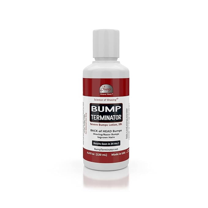 Bump Terminator Severe Bumps Lotion (4oz) - Walmart.com