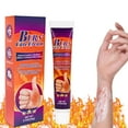 Burn Care Cream Scald Ointment Prevent Scars Moisturizing Analgesic ...