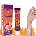 Burn Care Cream Scald Ointment Prevent Scars Moisturizing Analgesic ...