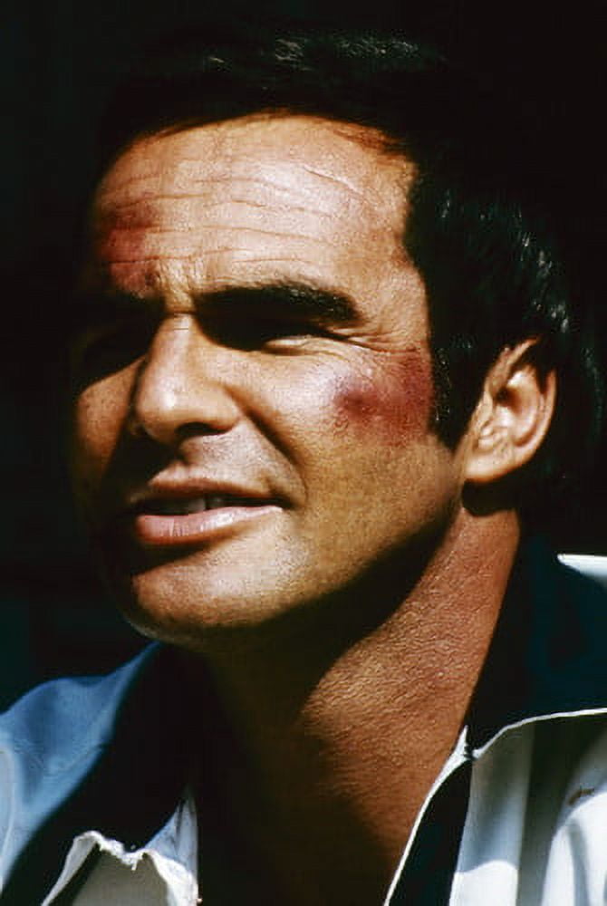 Burt Reynolds close up portrait bruised face 24x36 Poster - Walmart.com