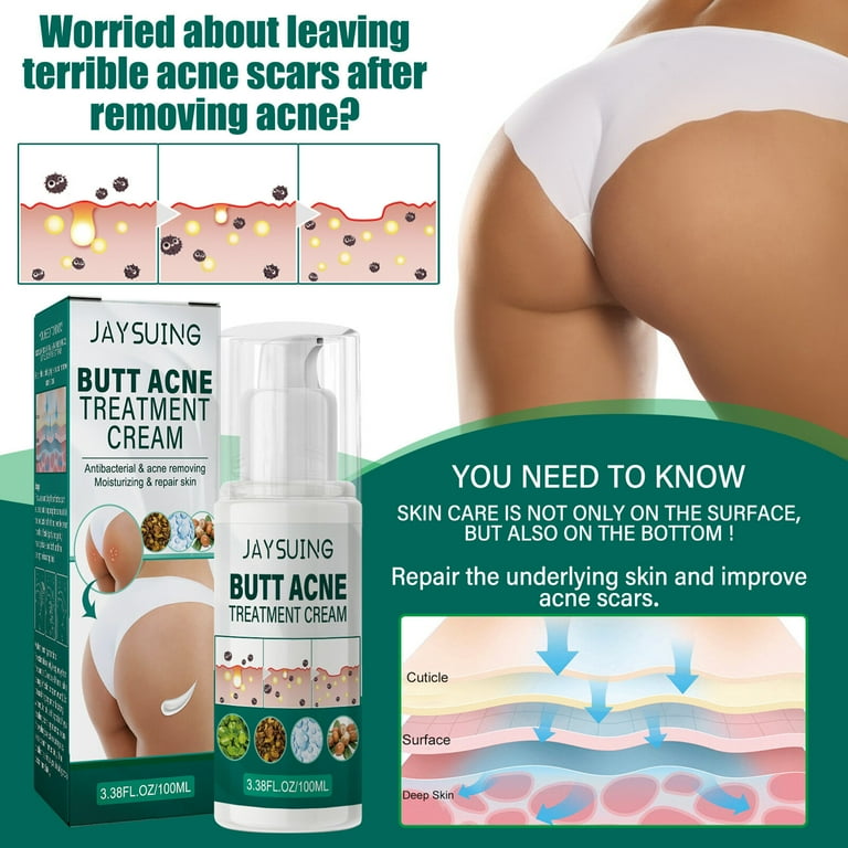 Butt acne products store