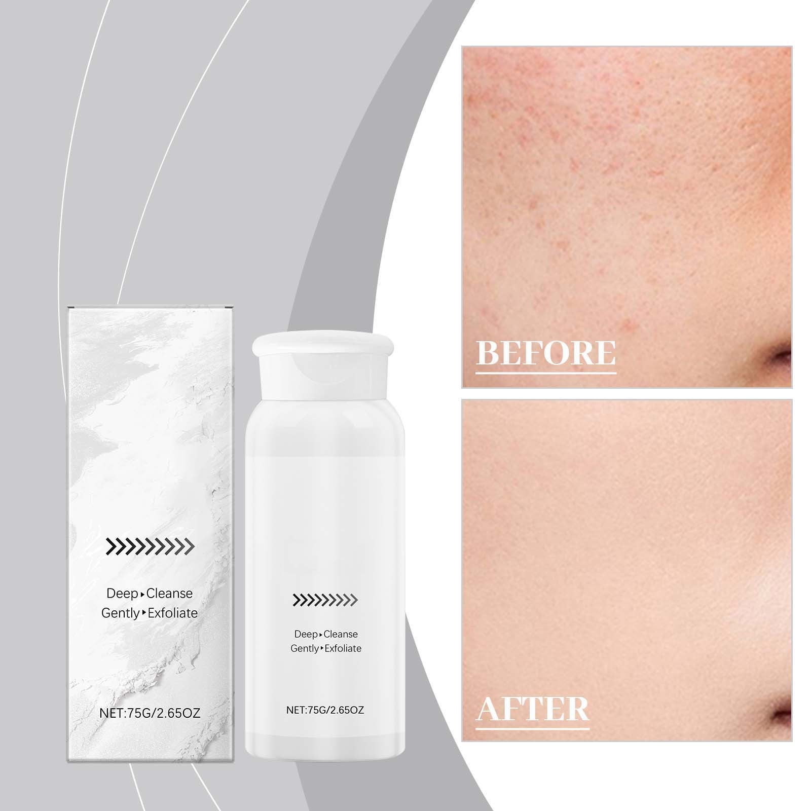 Byikun Enzyme Powder Cleanser, Gentle Exfoliating Rice Bran Oil recipe ...