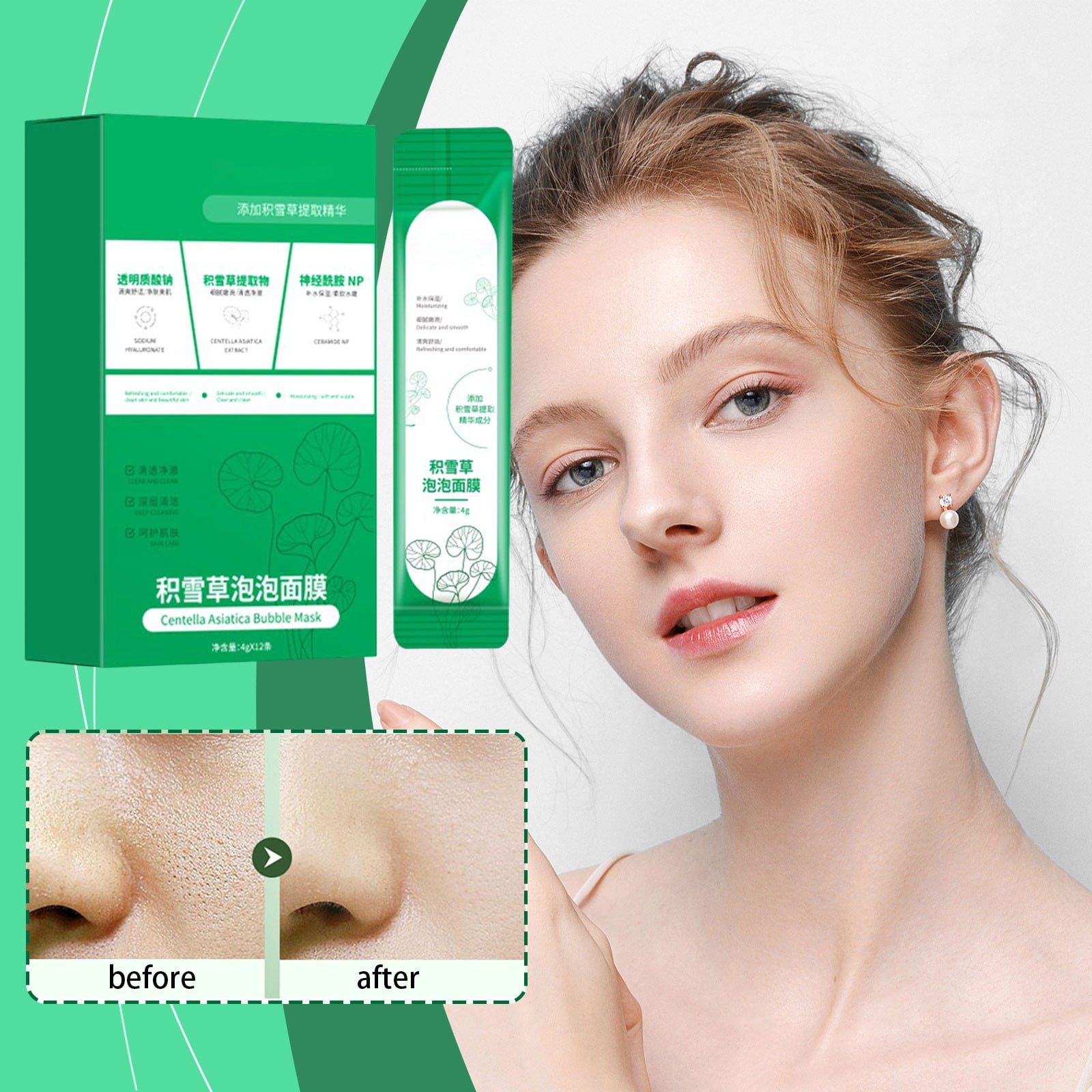 Byikun Foam Mask, Centella Asiatica Bubble Cleanser, Pore Purifying ...
